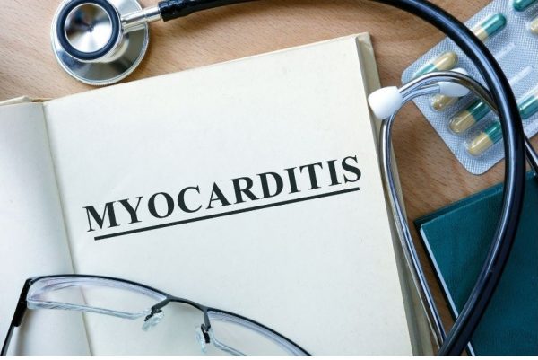 Miocardite: 10 possíveis sinais e sintomas